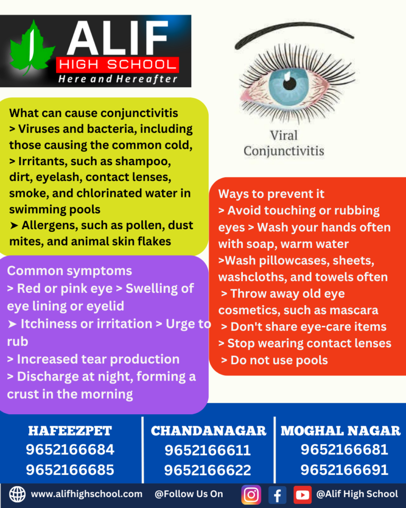 7 Effective Ways to Prevent Conjunctivitis - Blog - Alif High School
